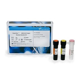 高純度シリカゲル使用HPLCカラム『Mightysilシリーズ』 | 関東化学株式会社 - Powered by イプロスものづくり