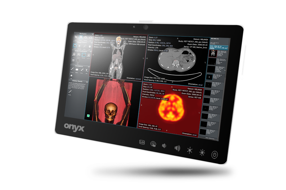 医療用スリムタッチパネルPC 15.6インチ【SMA-1533】 | V-net AAEON - Powered by イプロスものづくり