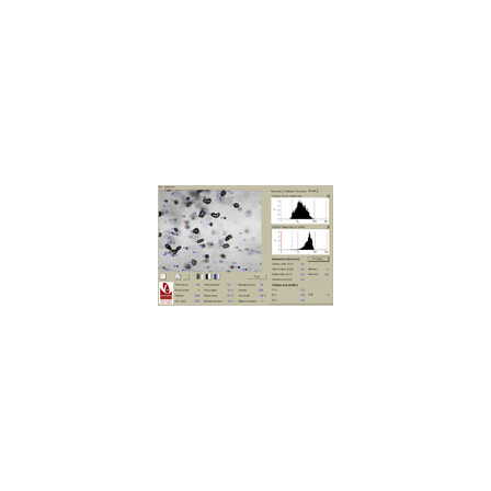 Particle size distribution/velocity distribution measurement device ...
